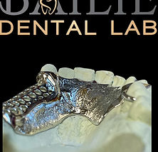 Projects – Bailie Dental Lab